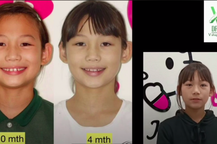 Welcome | V First Dental